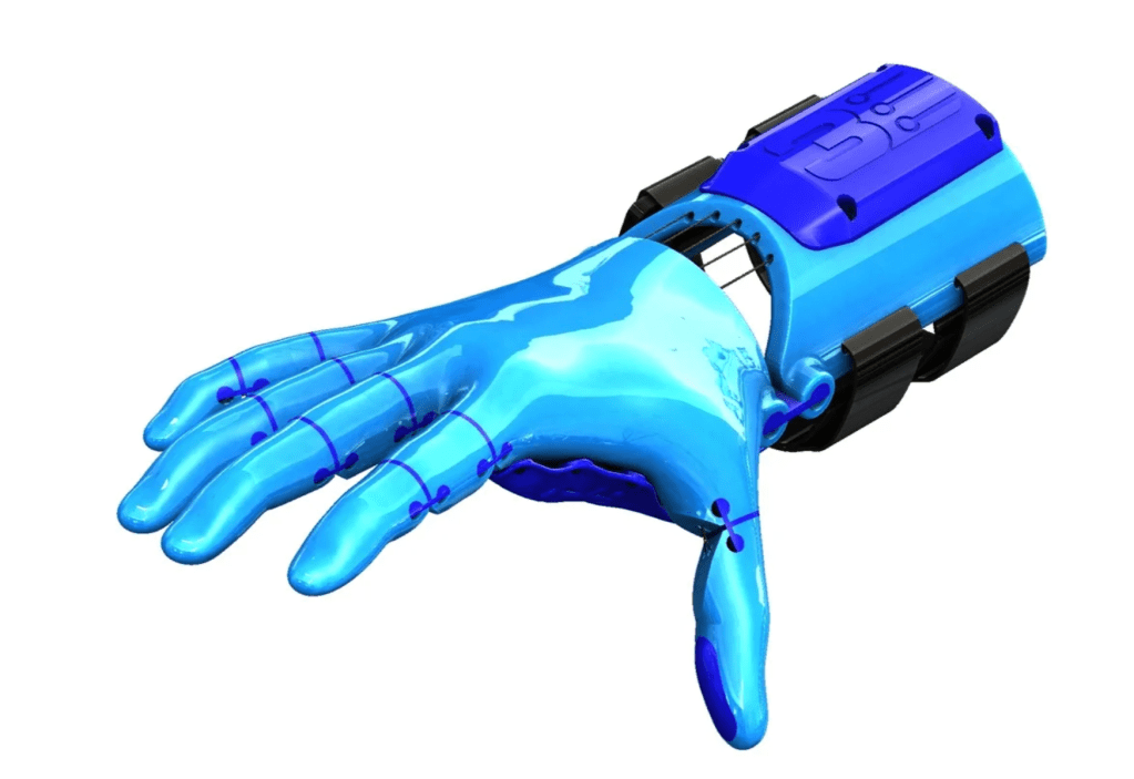 3D Printed Prosthetic Hand! – Design Technology Tutor